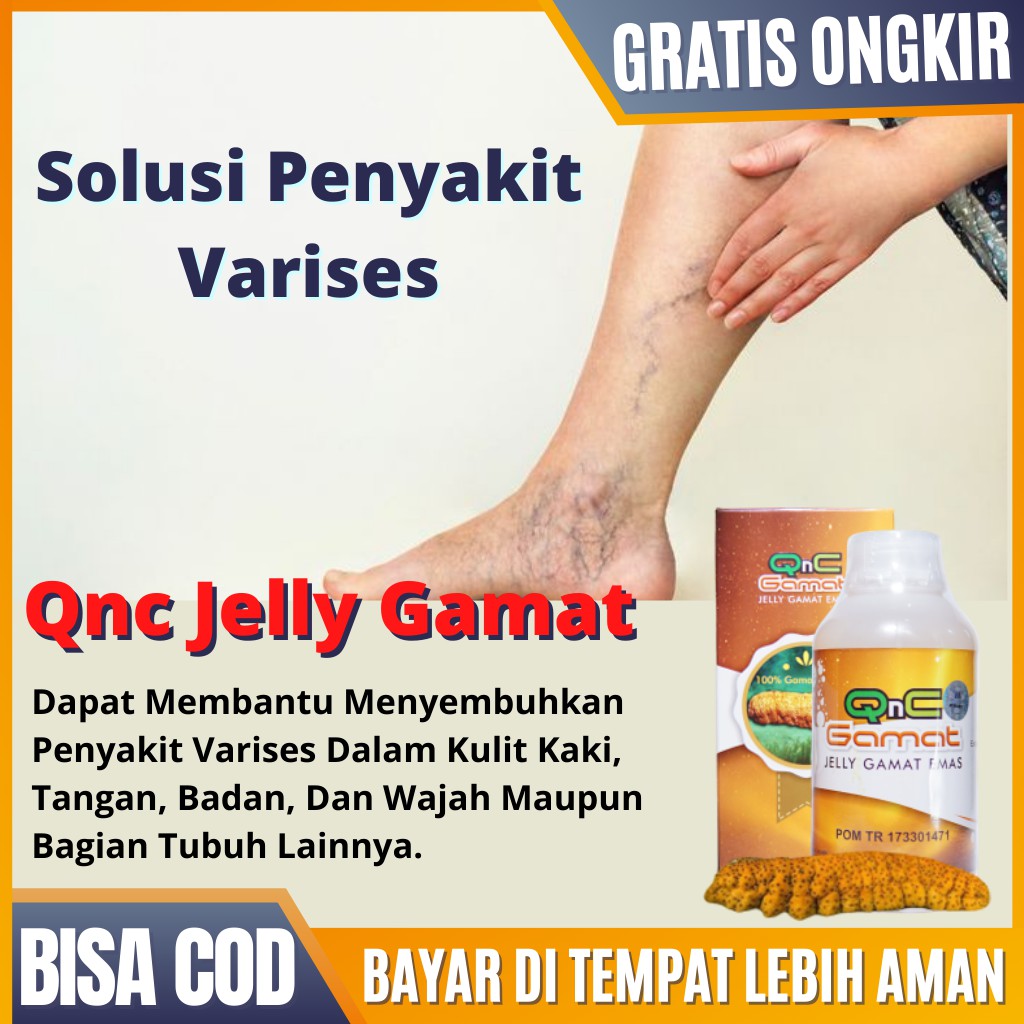 Jual Obat Varises Kaki , Paha, Tangan Original Herbal Terbaik - Qnc ...