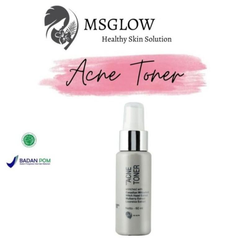 Jual ACNE TONER MS GLOW ( original ) | Shopee Indonesia