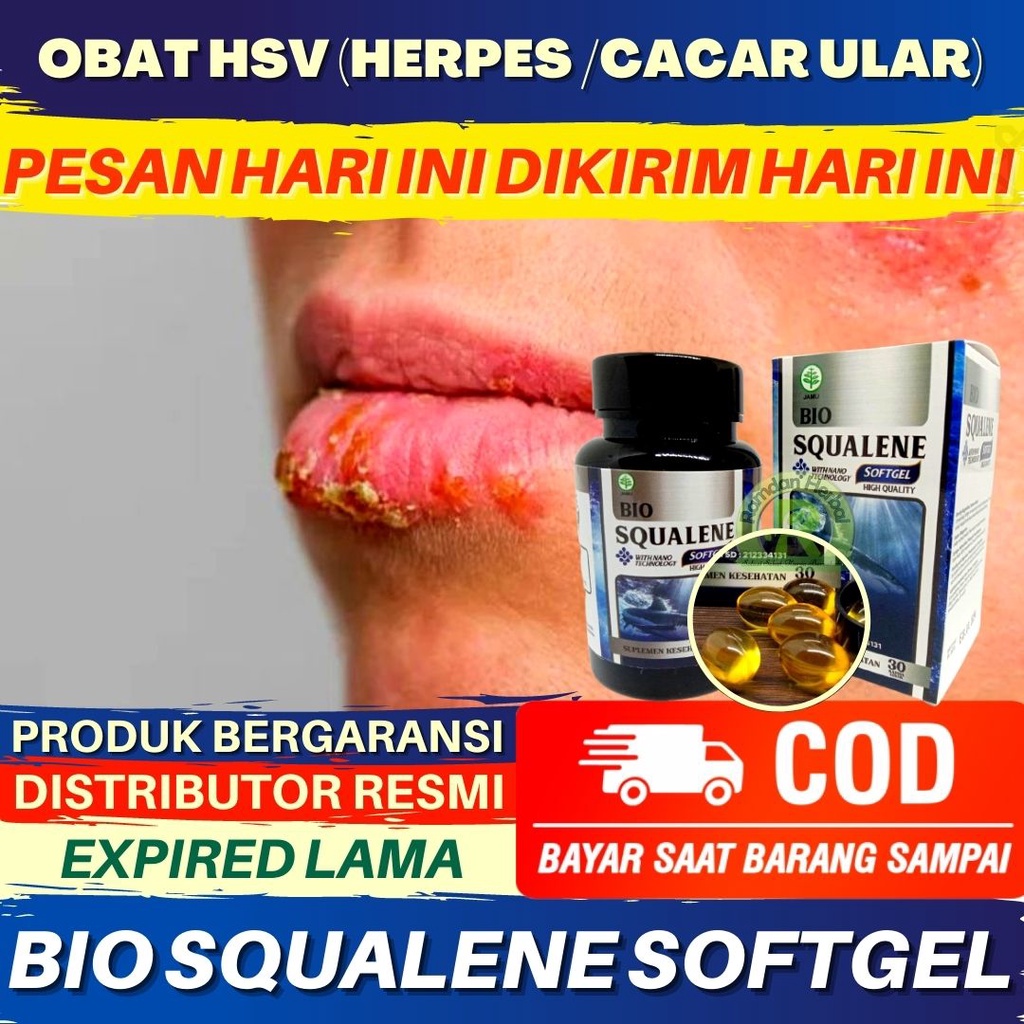 Jual Obat HSV Obat Cacar Ular Obat Virus Simplex Obat Herbal Herpes ...