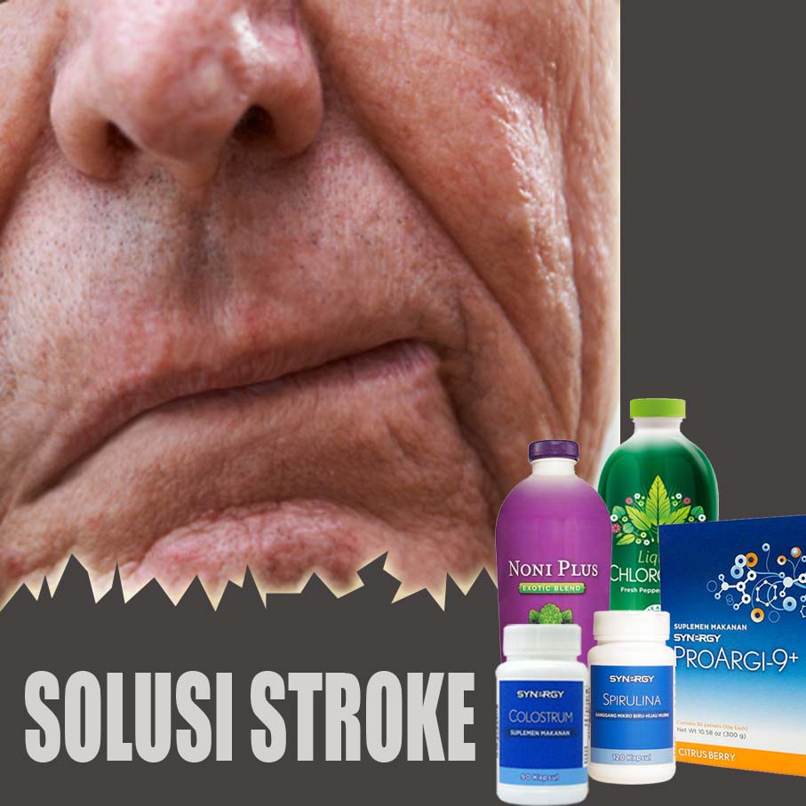 Jual Obat Buat Stroke (Chlorophyll+NoniPlus+ProArgi+Colostrum+Spirulina ...