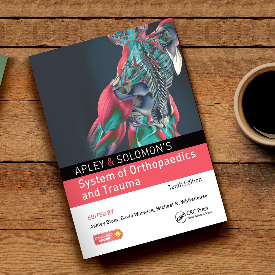 Jual Apley and Solomons system of orthopaedic and trauma 2018 10th ...