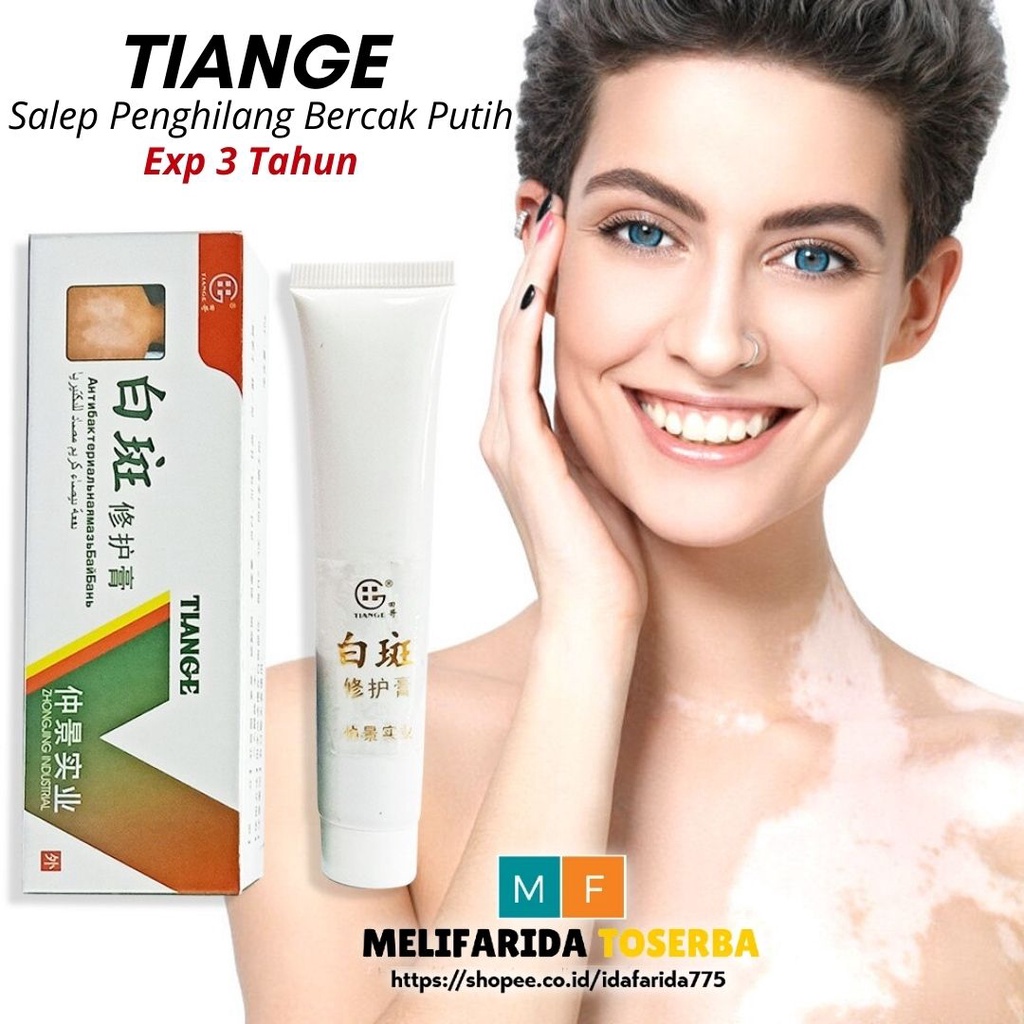 Jual Tiange TIANG E Obat Salep Vitiligo Obat Kulit Belang Bercak Putih ORI | Shopee Indonesia