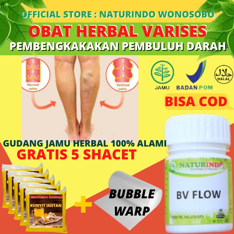 Jual OBAT HERBAL VARISES farises ( PEMBULUH DARAH MEMBESAR DAN TIMBUL ...