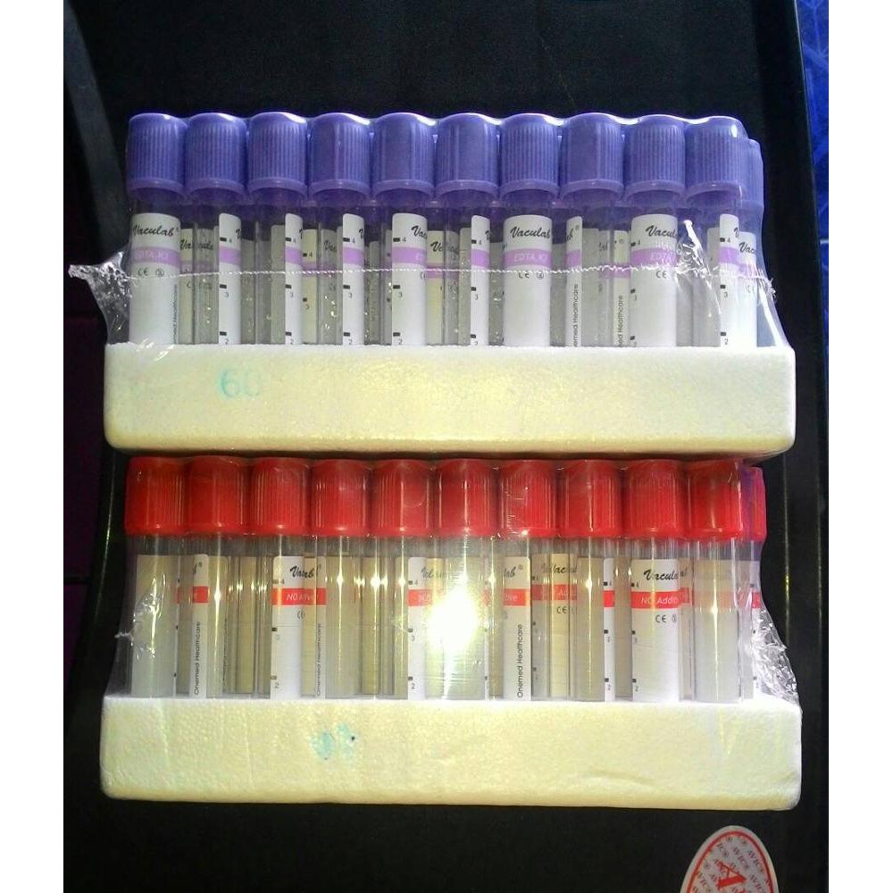 Jual Tabung edta / vaculab | Shopee Indonesia
