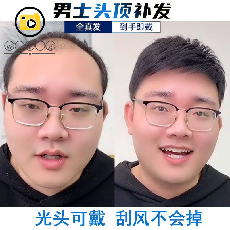 Jual Wig pria pengganti kepala potongan pria wig rambut asli tak ...