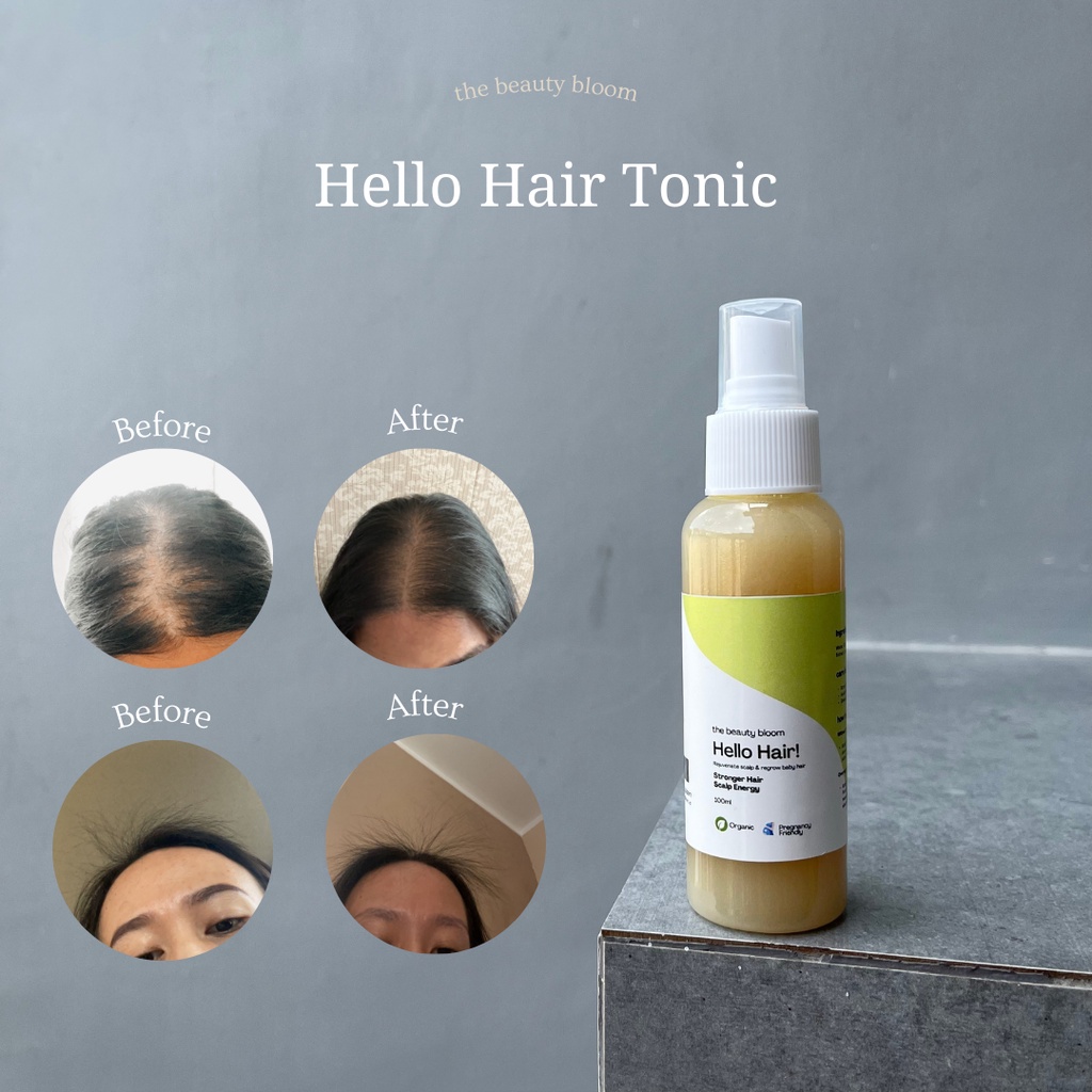 Jual Hair Tonic by the beauty bloom | Penumbuh Rambut Tipis / Botak ...