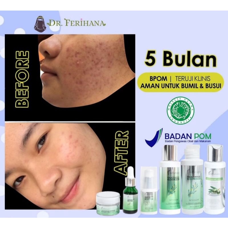 Jual FREE GIFT | PAKET GALACTOMYCES FOR OILY TO ACNE DR. FERIHANA COSMETICS ...