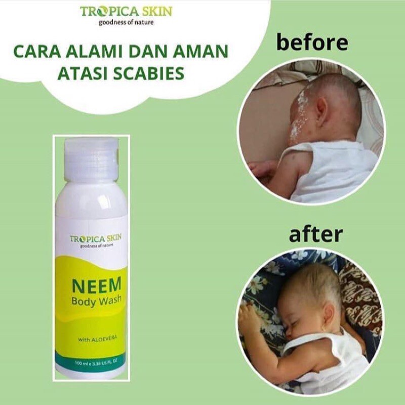 Jual sabun gatal / obat eksim / obat scabies / obat gatal / obat alergi ...