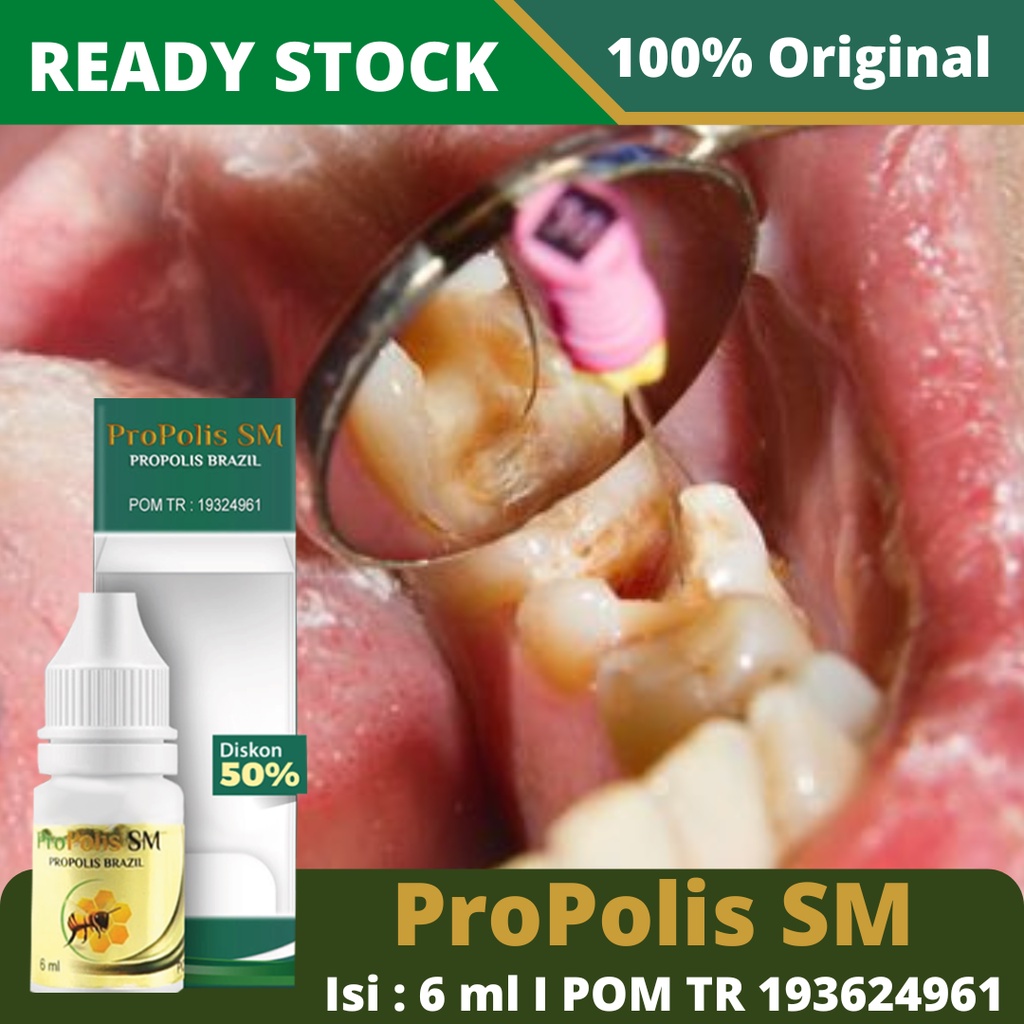 Jual Obat Polip Pulpa Gigi, Penghilang Daging Jadi Di Gusi, Polip Gigi ...