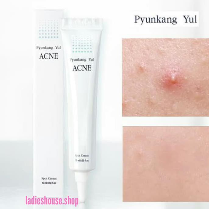 Jual PYUNKANG YUL Acne Spot Cream 15ml | Shopee Indonesia