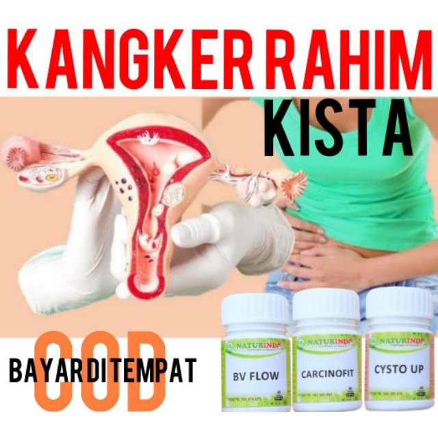 Jual OBAT HERBAL KISTA MIOM KANKER KANDUNGAN PENDARAHAN FLEK NYERI ...