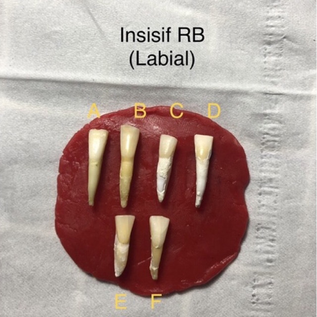 Jual JUAL GIGI INSISIF RB (PRAKTIKUM) | Shopee Indonesia