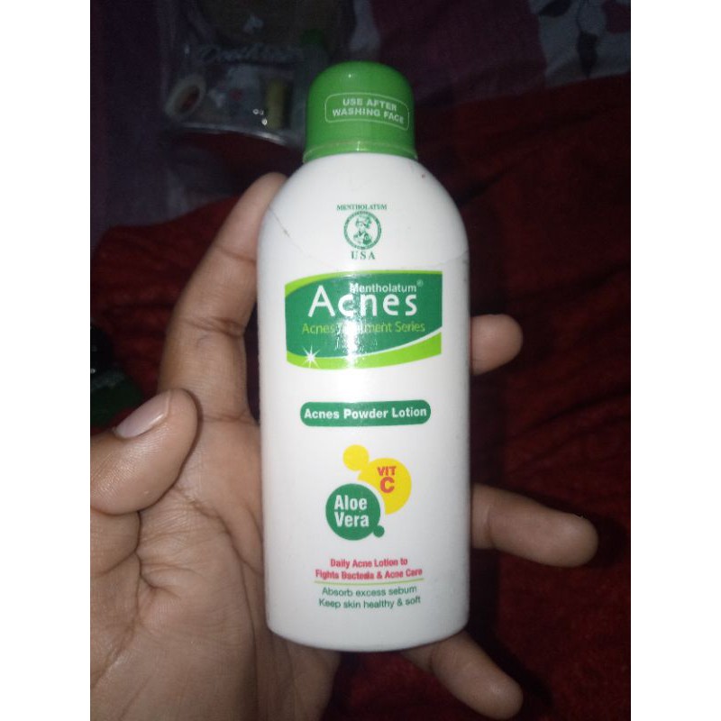 Jual acnes powder lotion 100ml | Shopee Indonesia