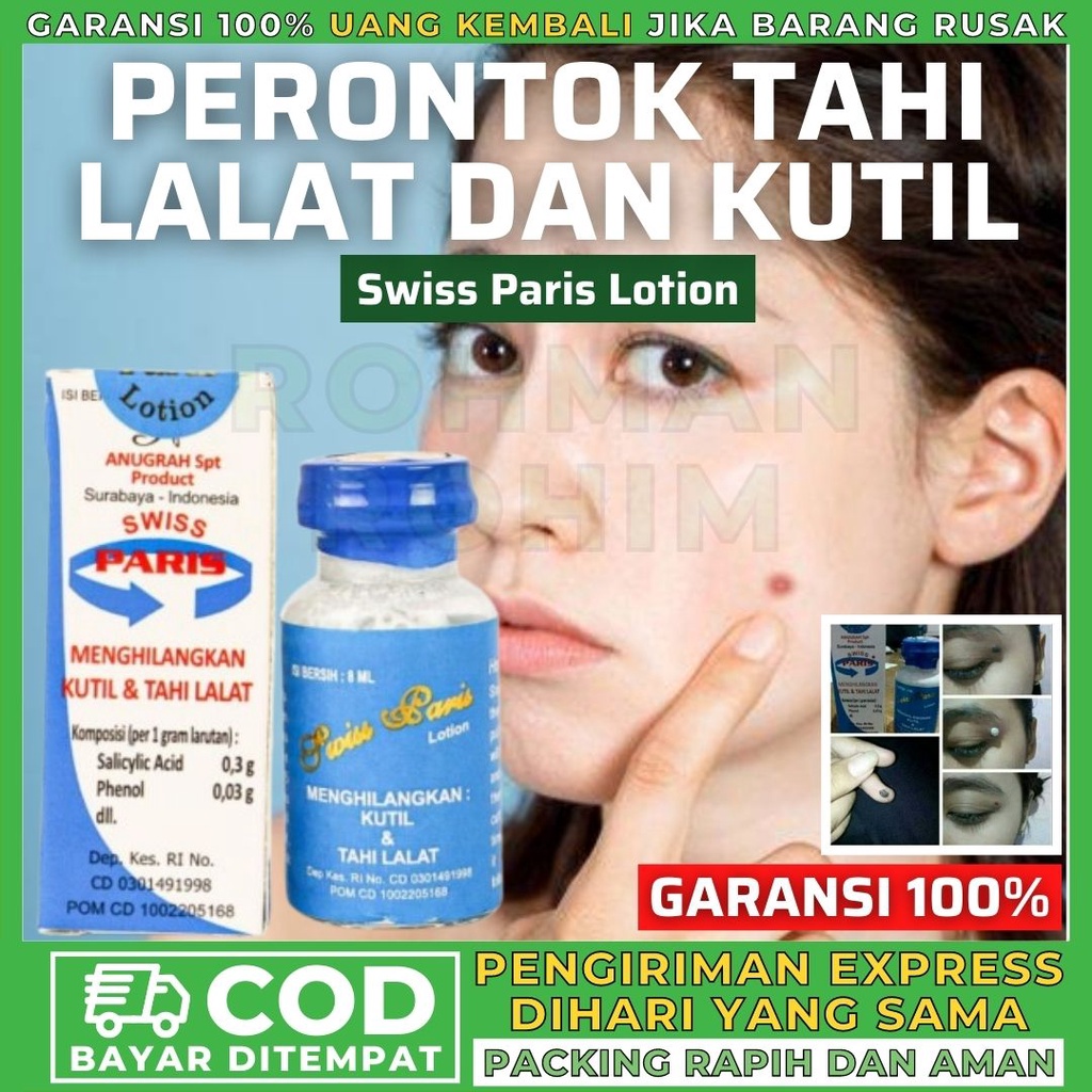 Jual SWISS PARIS LOTION PENGHILANG KUTIL TAHI LALAT KELOID TOMPEL ...