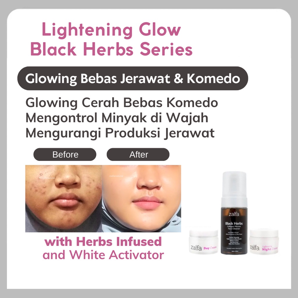 Jual [FREE ONGKIR] Paket Lightening Black Herbs Series Zalfa Natural ...