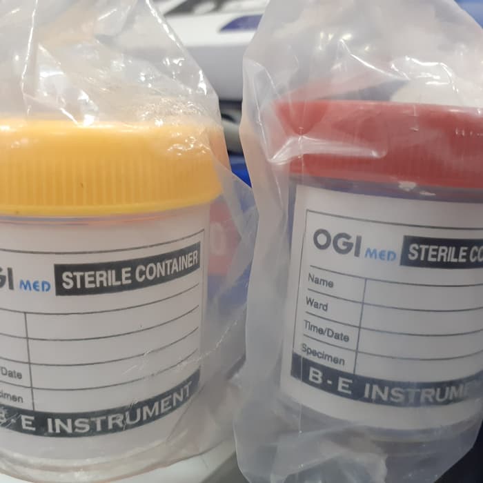 Jual Urine Container Non Steril 60ml New Penampung Urine Yellow ...