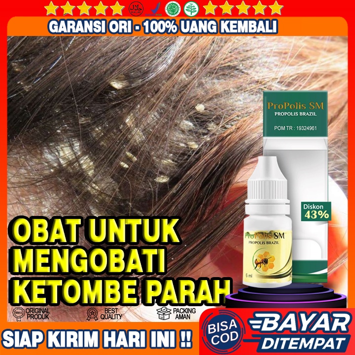 Jual Obat Ketombe Parah, Kulit Kepala Kering Berkerak, Rambut Banyak Ketombe, Rambut Gatal ...