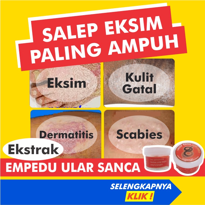 Jual Salep Obat Gatal Eksim Kering Menahun Paling Ampuh Saleb Kulit ...