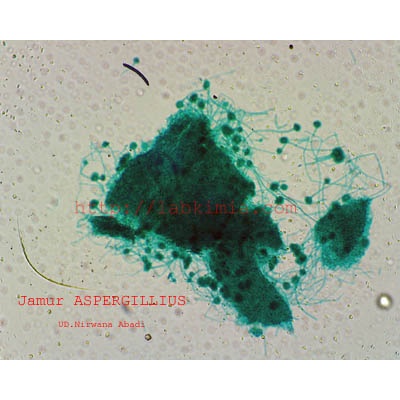 Jual PREPARAT KERING 17 MACAM / SET ORIGINAL - BISA COD | Shopee Indonesia