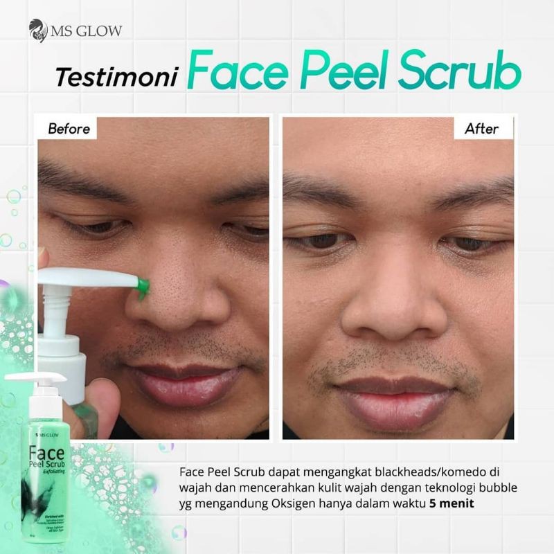 Jual FACE PEEL SCRUB MS GLOW ORIGINAL Shopee Indonesia