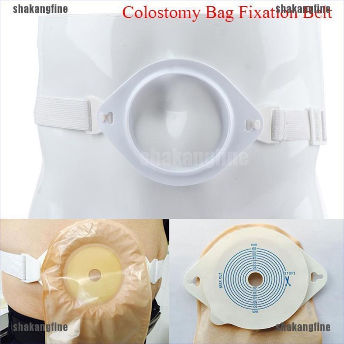 Jual Adjustable Ostomy Reinforcement Colostomy Bag Fixation Reinforced ...