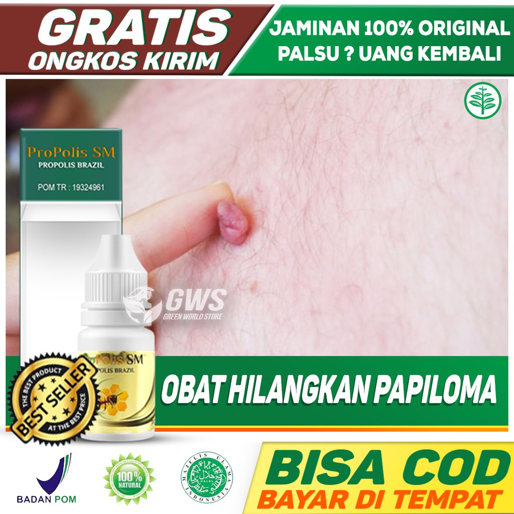 Jual Obat Papiloma, Penghilang Papiloma, Papiloma di Leher dan Wajah ...