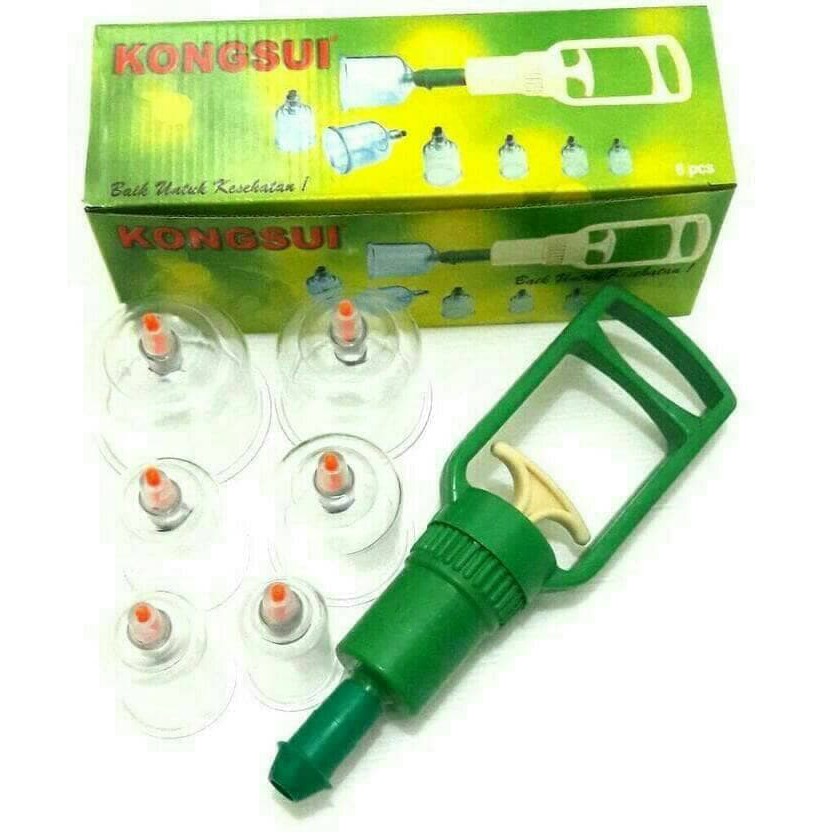 Jual KOP ANGIN KONGSUI 6 TABUNG KOP ANGIN ALAT KESEHATAN MASUK ANGIN ALAT BEKAM | Shopee Indonesia