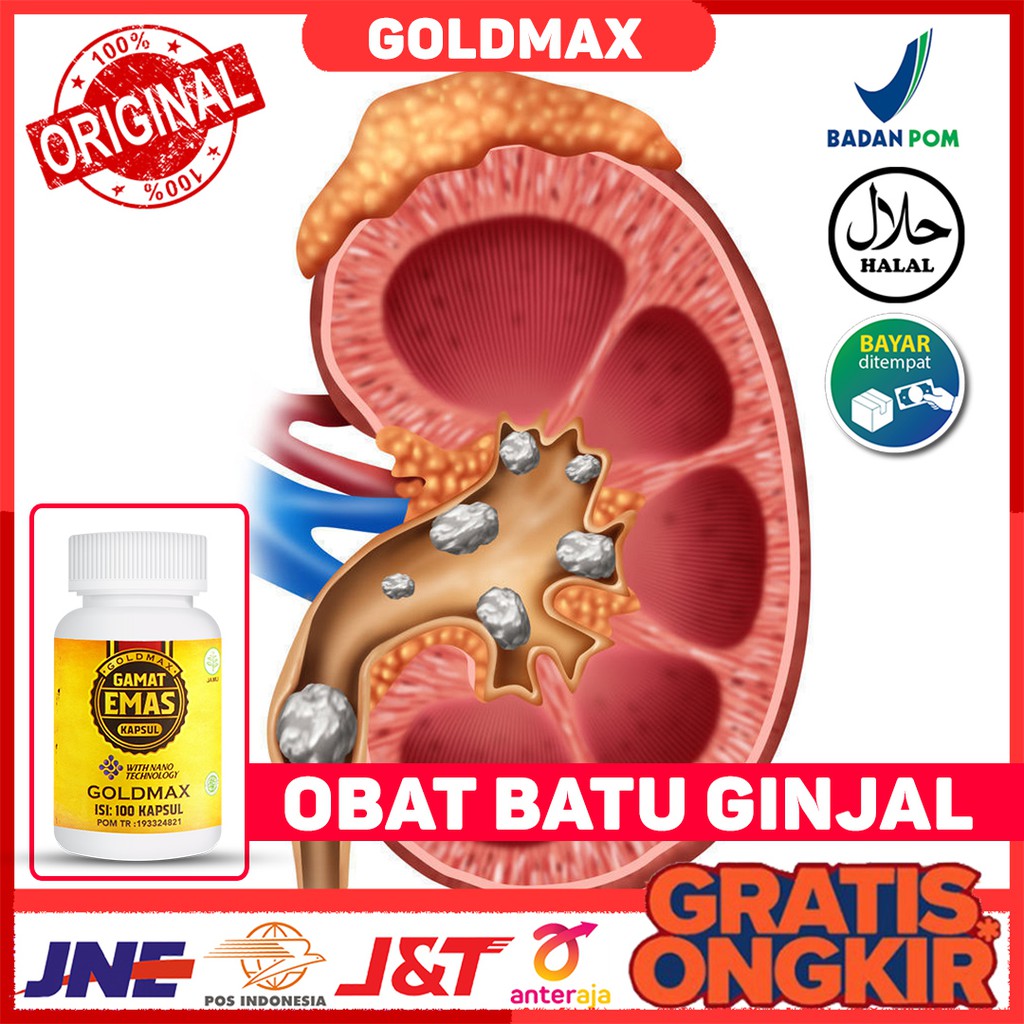 Jual Obat Batu Ginjal, Batu Ginjal Kronis, Gagal Ginjal, Penghancur Batu Ginjal - Goldmax di ...