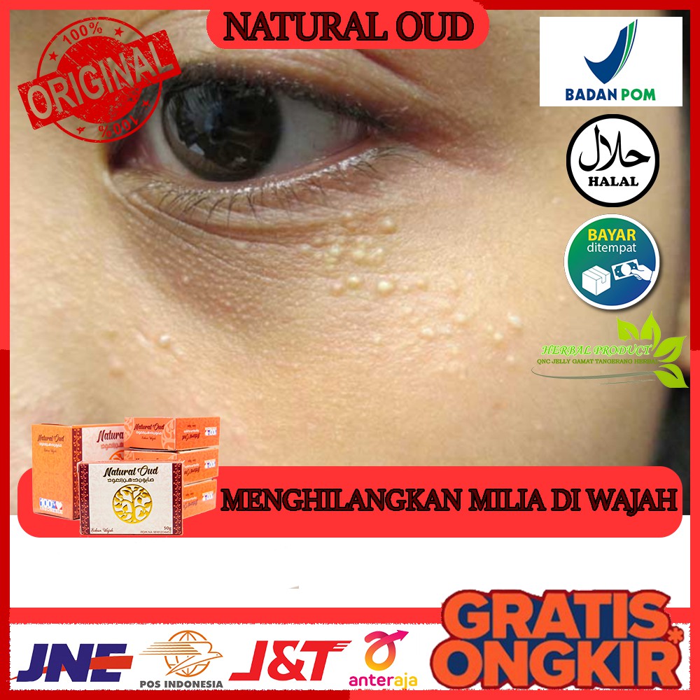 Jual Menghilngkan Milia, Bopeng, Jerawat, Bintik Putih, Komedo, Flek ...