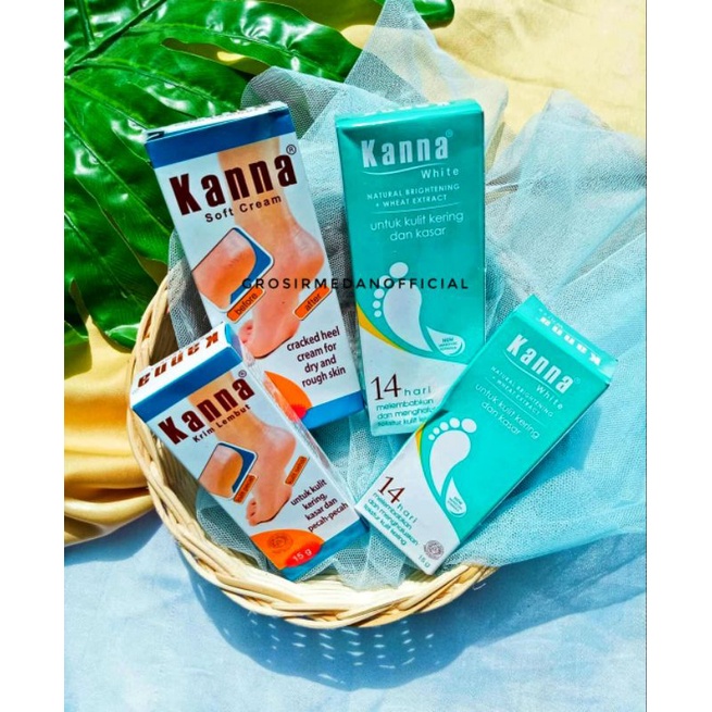 Jual KANNA CREAM - KANNA WHITE - UNTUK KULIT KERING KASAR DAN PECAH ...