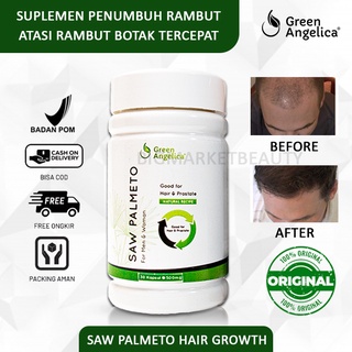 Jual BEST SELLER Suplemen Herbal Penumbuh Rambut Alami Cepat Ampuh ...