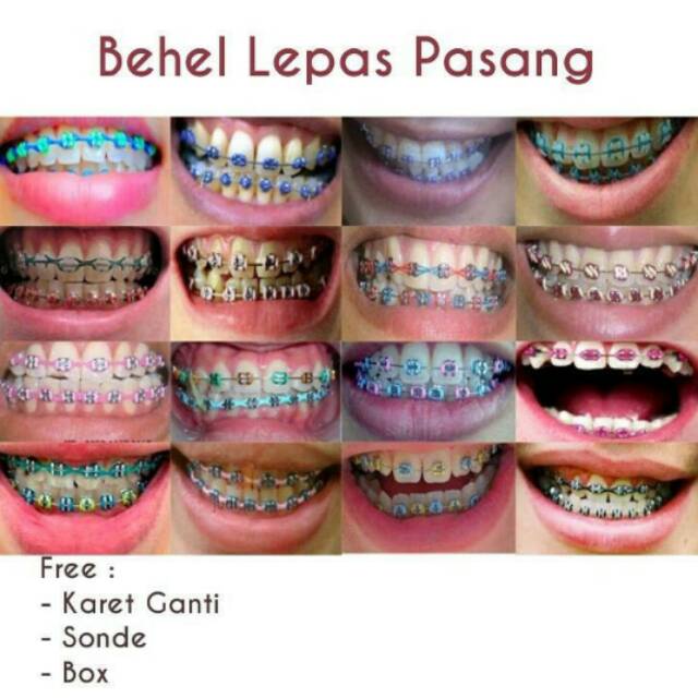 Jual BEHEL LEPAS PASANG 1 BUAH ATAS atau BAWAH SAJA | Shopee Indonesia