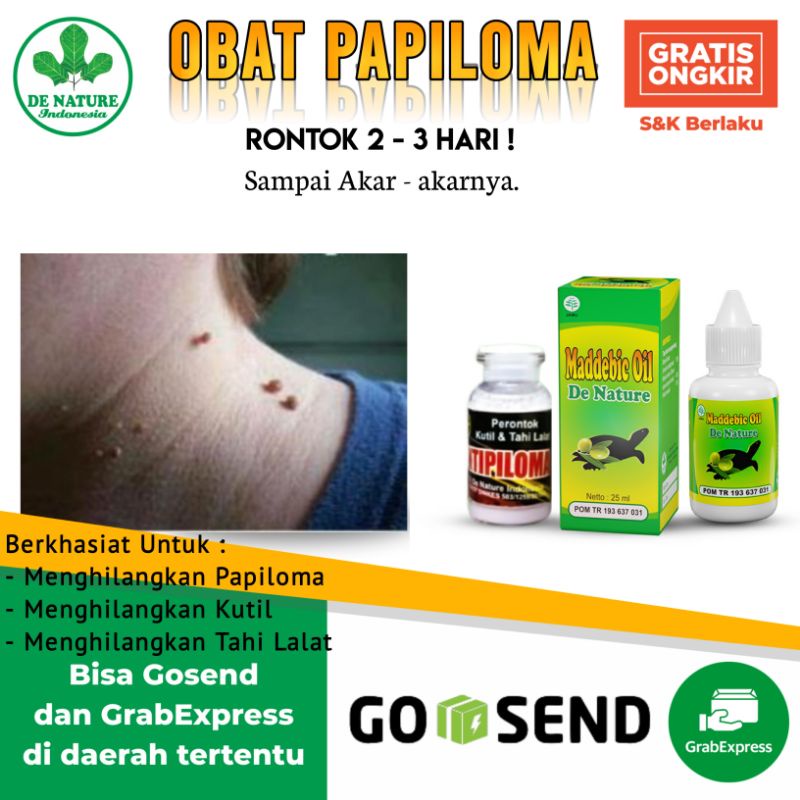 Jual Obat Penghilang Papiloma Kondiloma Kutil dan Tahi Lalat di Leher ...