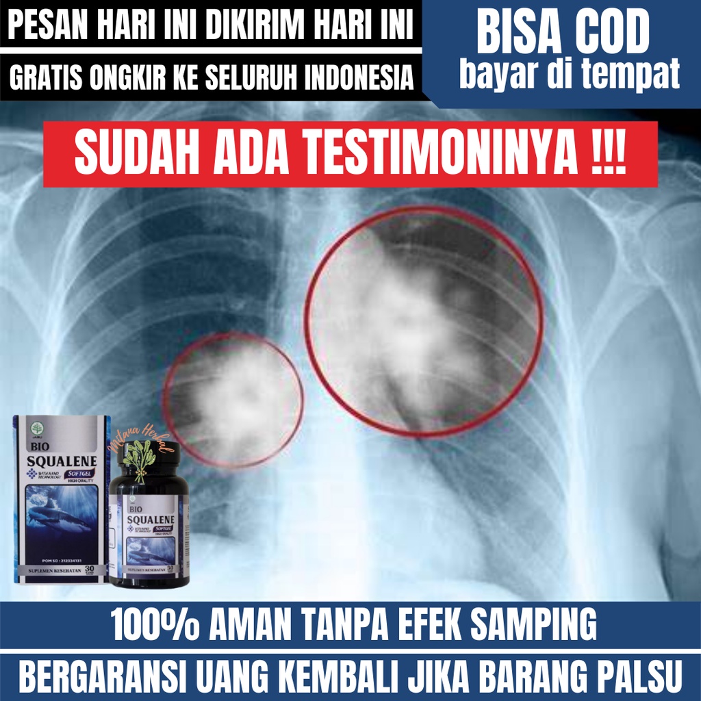 Jual Obat Herbal Pneumonia, Obat Flek Paru-Paru Dewasa Dan Anak, Obat ...