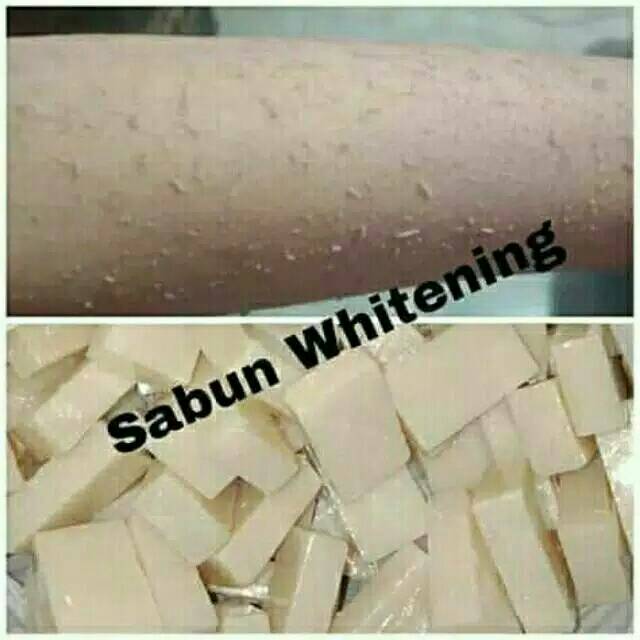 Jual Sabun Daki Super / Sabun Bolot / Perontok Bolot / Perontok Daki ...