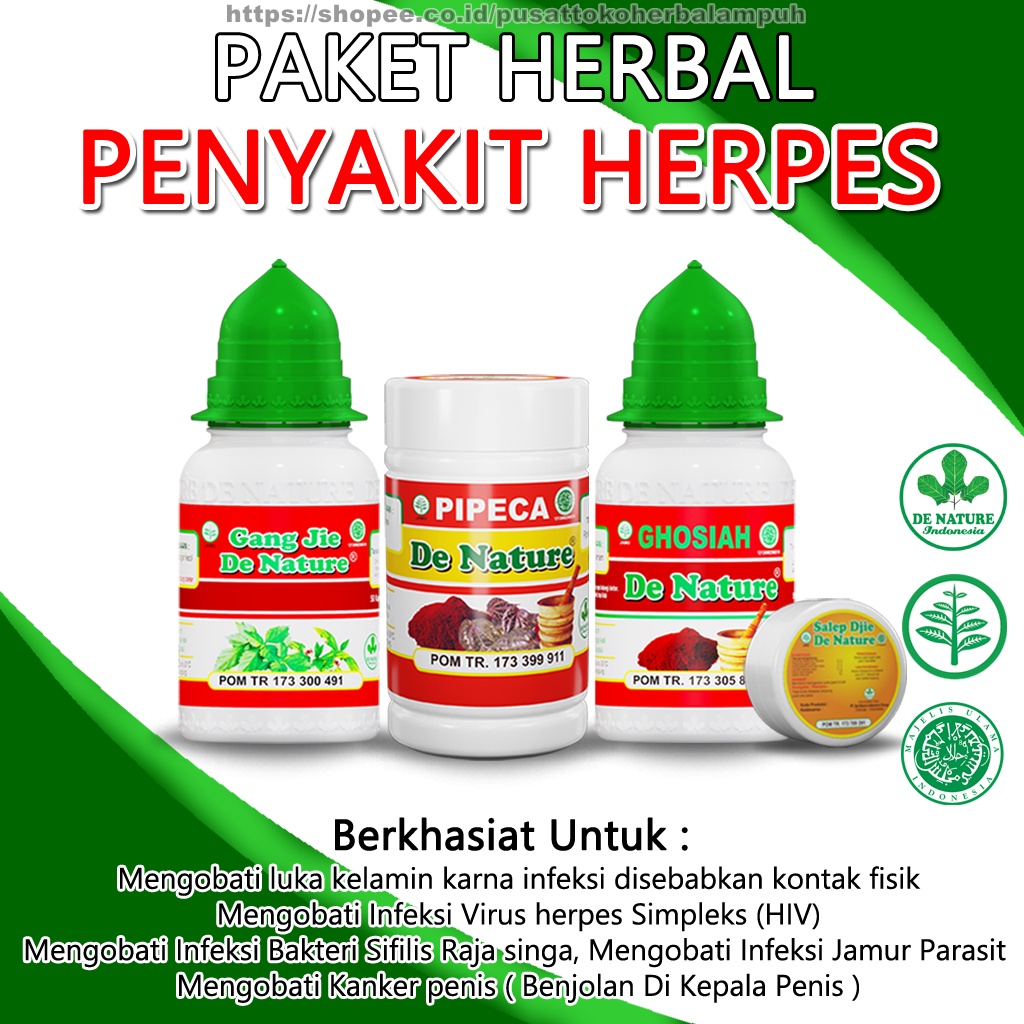 Jual Obat Herbal Herpes Simpleks, zoster De Nature Asli Obat Luka ...