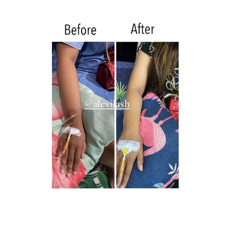 Jual INFUS WHITENING PAKET | Shopee Indonesia