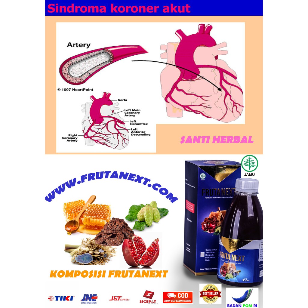 Jual FRUTANEXT OBAT SINDROM KORONER AKUT -OBAT ATRIALFIBRILASI - OBAT ...