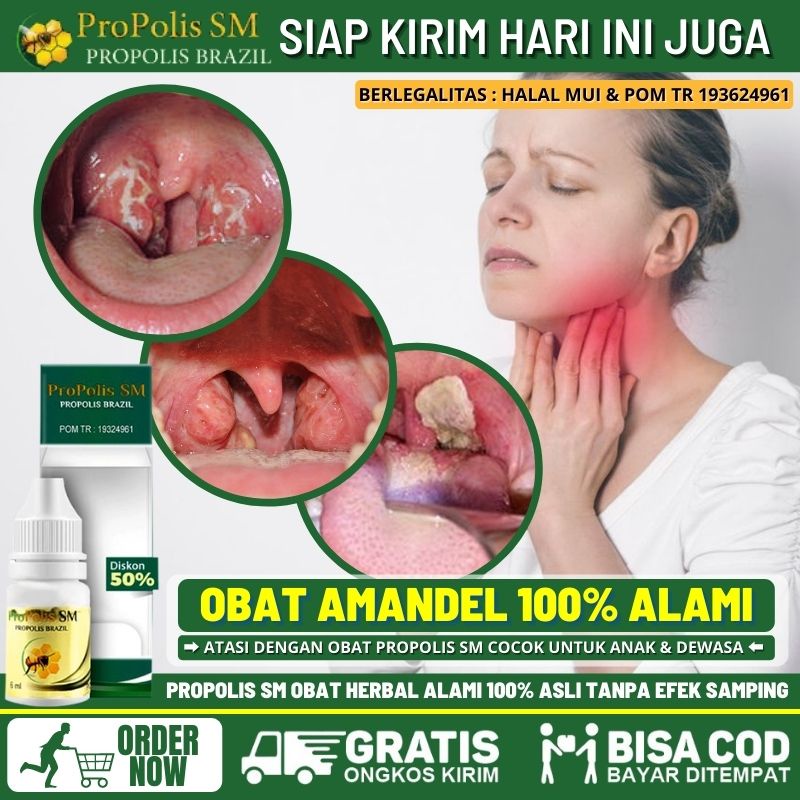 Jual Obat Herbal Khusus Amandel, Obat Amandel Untuk Anak & Dewasa, Obat Mengempiskan Amandel ...