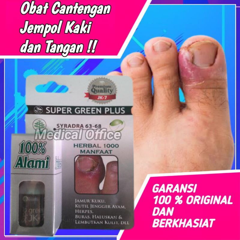 Jual ORIGINAL OBAT KUKU SAKIT CANTENGAN, JAMUR KUKU CAPLAK | Shopee ...