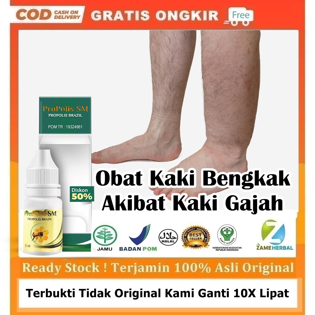 Jual Obat Kaki Bengkak Akibat Kaki Gajah, Obat Filariasis Akut, Obat ...