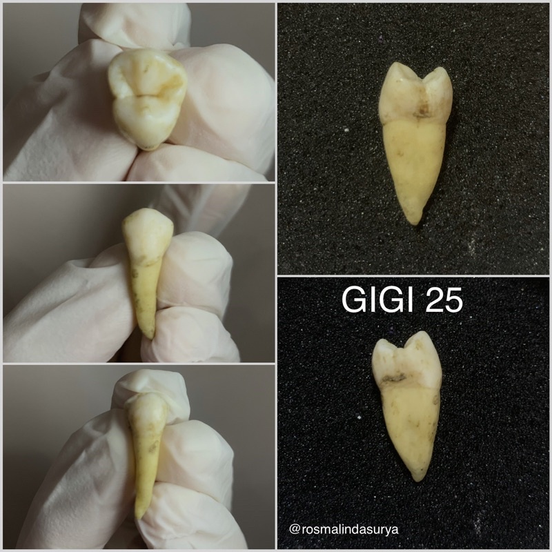 Jual GIGI 25 KONSER ENDO | Shopee Indonesia