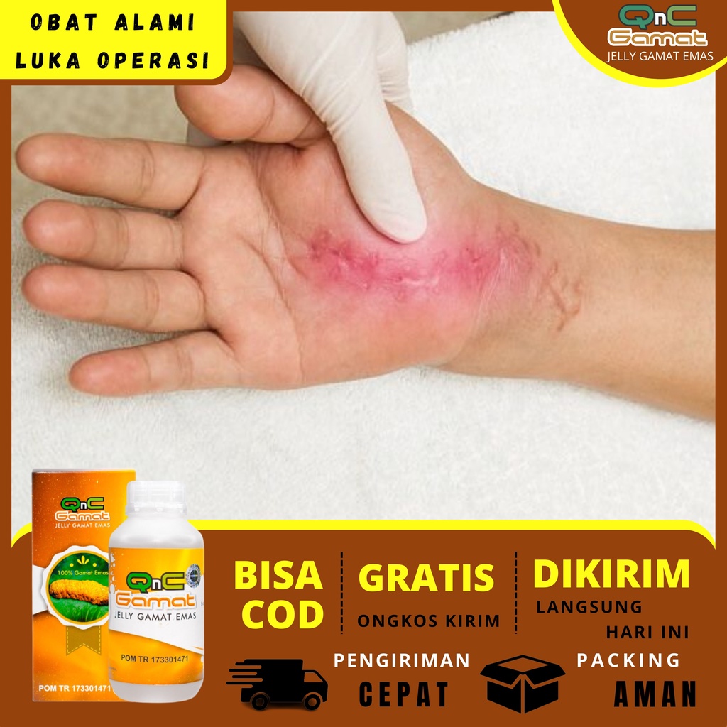 Jual Obat Pengering Luka Pasca Operasi Caesar Luka Bekas Operasi ...