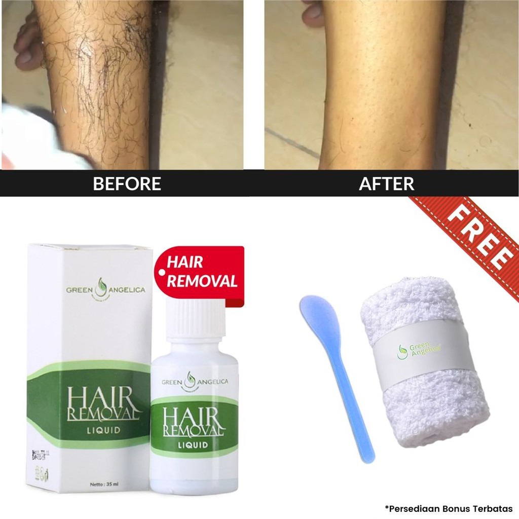 Jual Green Angelica Hair Removal Perontok Bulu Ketiak Kaki Dan Tangan ...