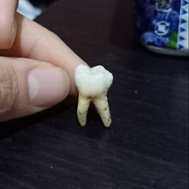 Jual GIGI MOLAR 36, PERFECT. GIGI ASLI PRAKTIKUM | Shopee Indonesia