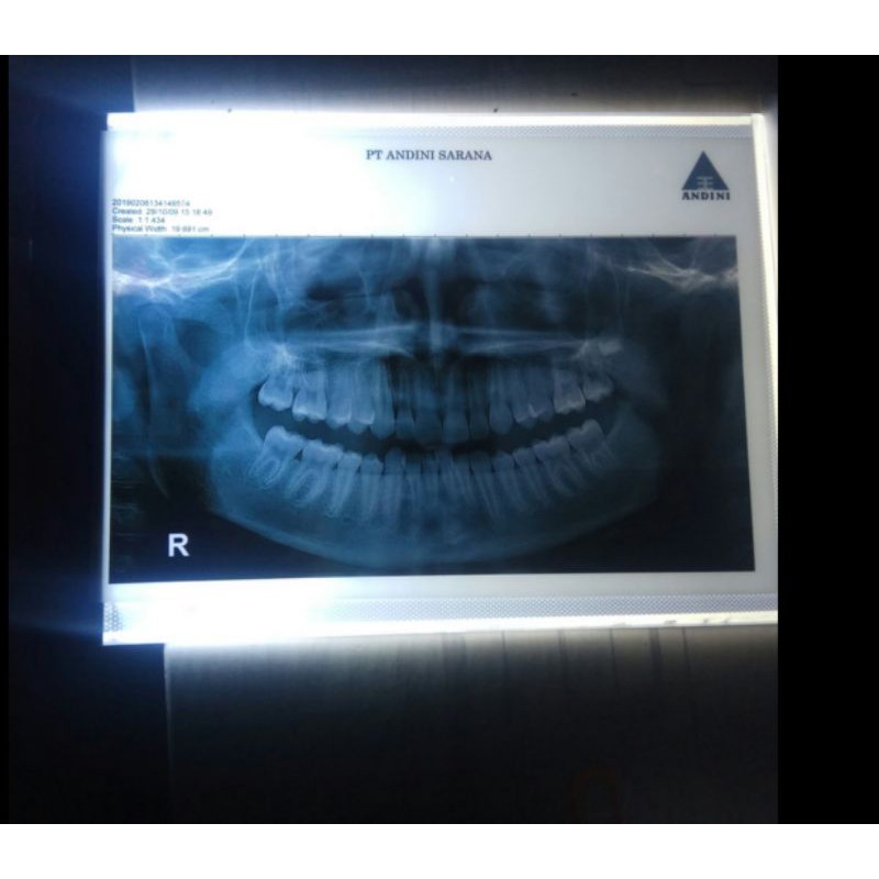 Jual Dental Viewer X-Ray LED Rontgen Portable A4 Slim | Shopee Indonesia