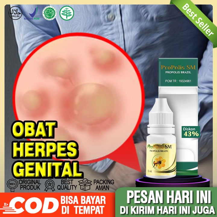 Jual Obat Herpes Genital, Herpes Kelamin, Kulit Cacar, Dompo - ProPolis ...