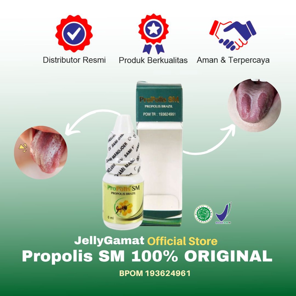 Jual Obat Lidah Berjamur dan Mati Rasa Lidah Putih Nyeri Saat Menelan ...