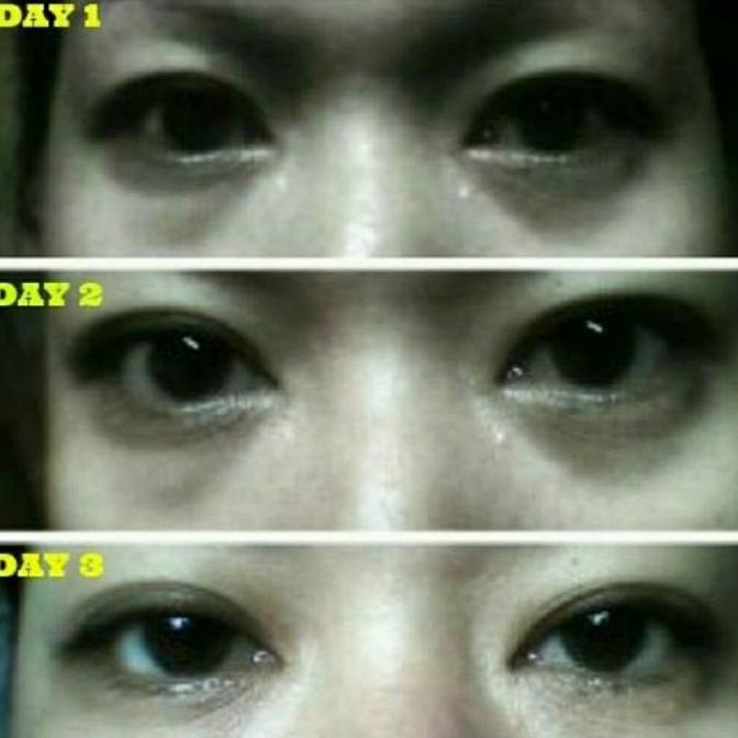 Jual CELETEQUE BRIGHTENING EYE TUCK PLUS DARK CIRCLES LIGHTENER CREAM ...