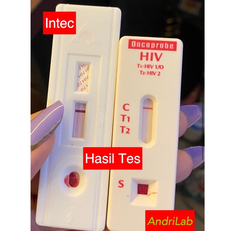 Jual Tes HIV 2 Merk HIV Oncoprobe dan HIV Intec isi 2 Pcs | Shopee ...